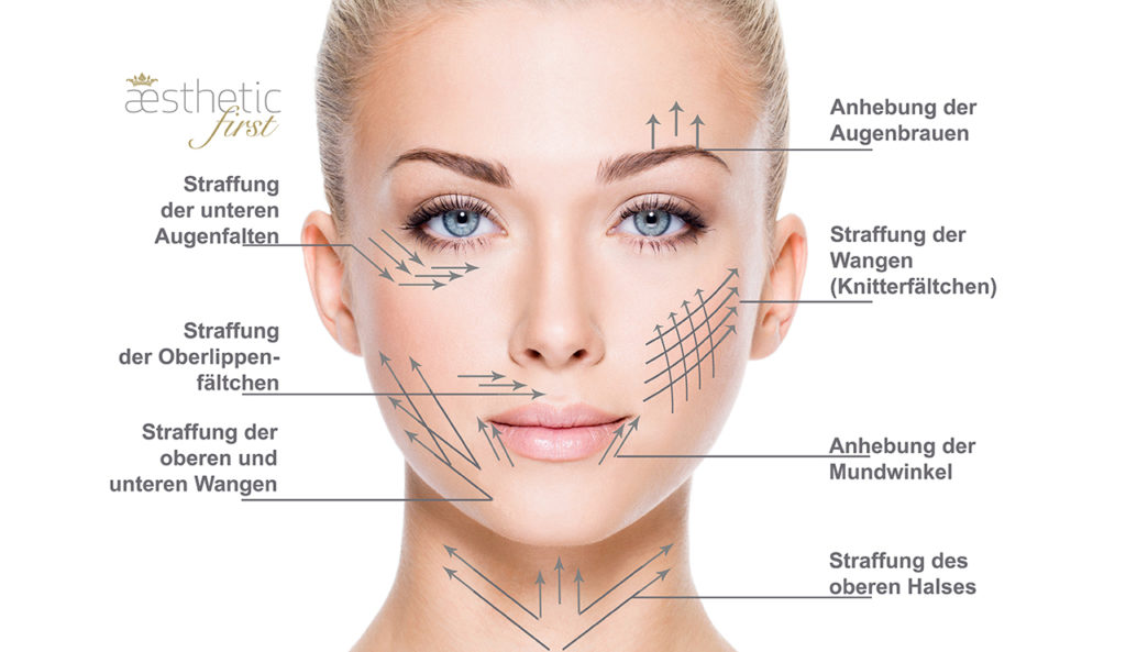 Aesthetic First – die Praxisklinik für Fadenlifting in – Köln – Düsseldorf – Bonn – NRW ...